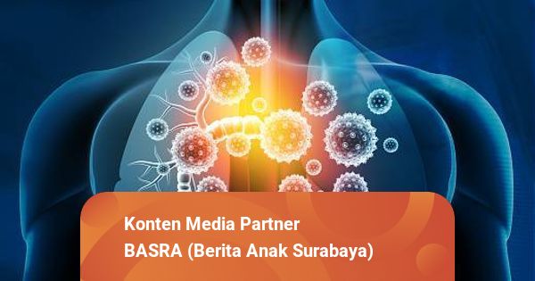 Gejala Awal TBC Anak | kumparan.com