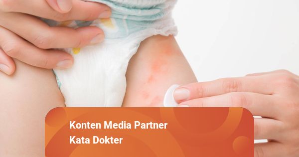 Bercak Merah pada Kulit Paha: Gejala, Penyebab, dan Cara Mengobati ...