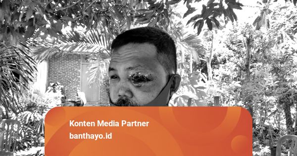 Akibat Makan Sapi Berpenyakit, 23 Warga Gorontalo Terpapar Antraks ...