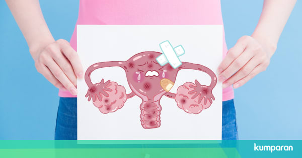 Rahim Terbalik, Apa Maksudnya? - kumparan.com