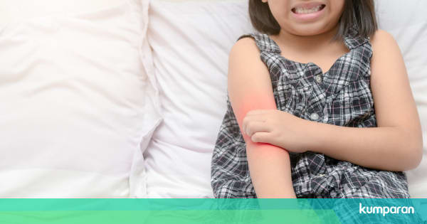 Penyebab dan Cara Mengobati Kaligata pada Anak - kumparan.com