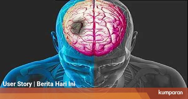 Metode FAST, Langkah Awal Mengenal Gejala Stroke - kumparan.com