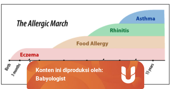 Jenis-Jenis Alergi Pada Si Kecil - kumparan.com